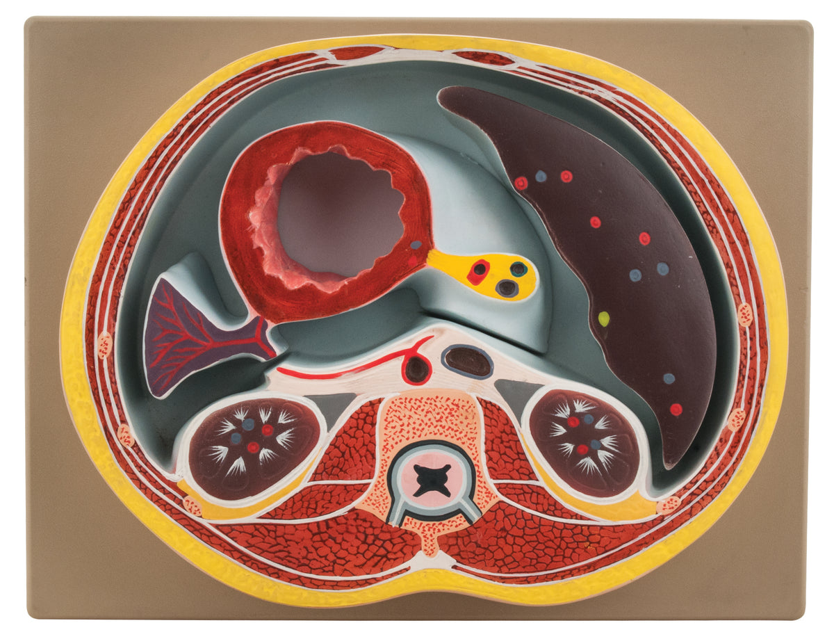 Model Human Abdomen Section — Eisco Labs