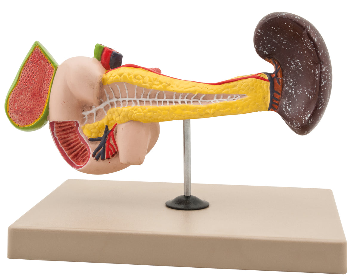 Spleen Pathology — Eisco Labs