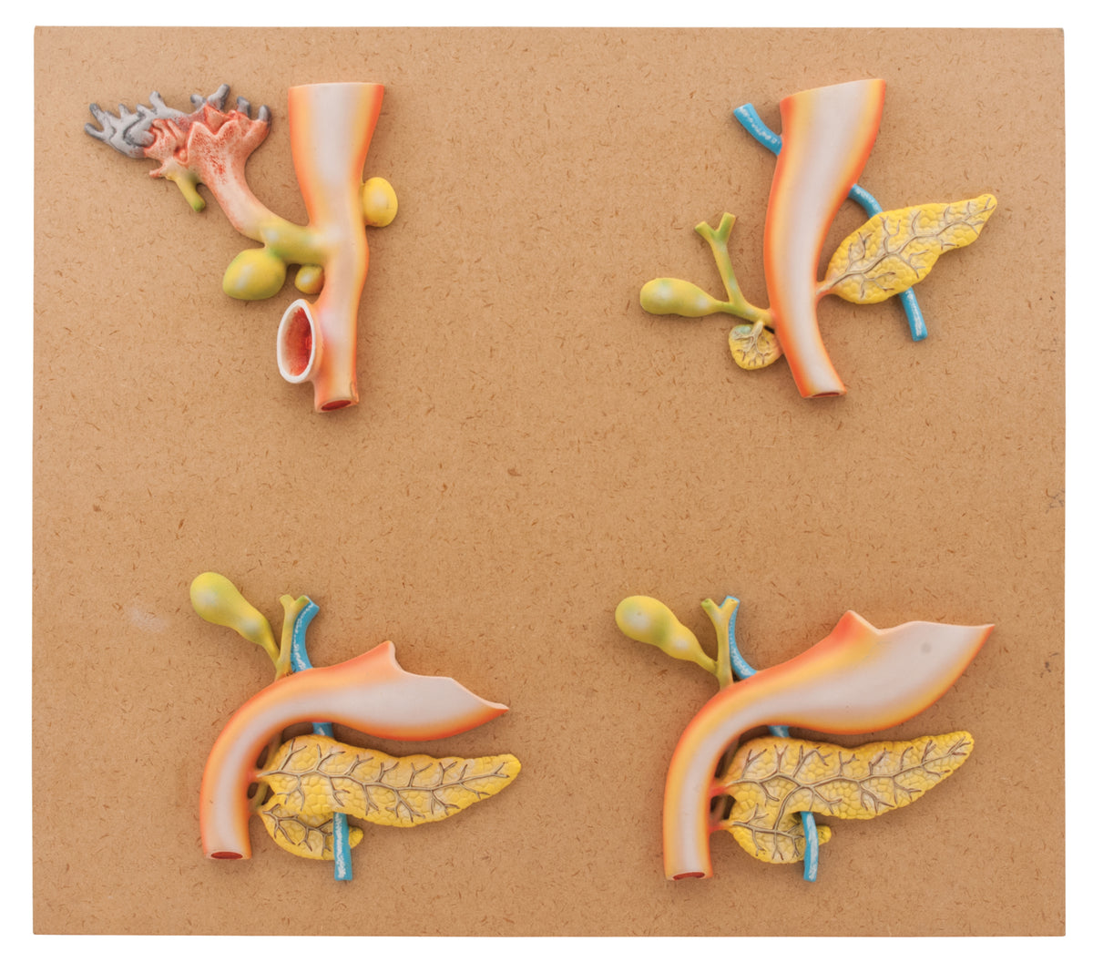 Abdominal Foregut Organ Development Set Of 4 — Eisco Labs