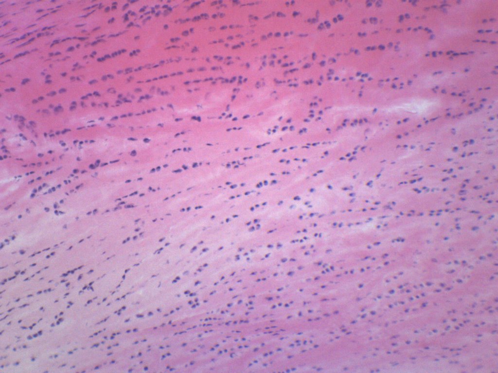 Fibrocartilage Slide 400x