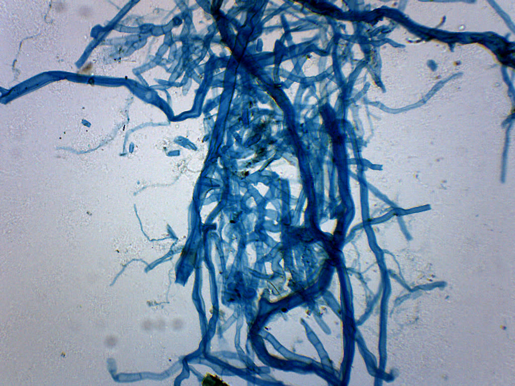 Moss Protonema Slide Prepared Slides — Page 2 — Eisco Labs