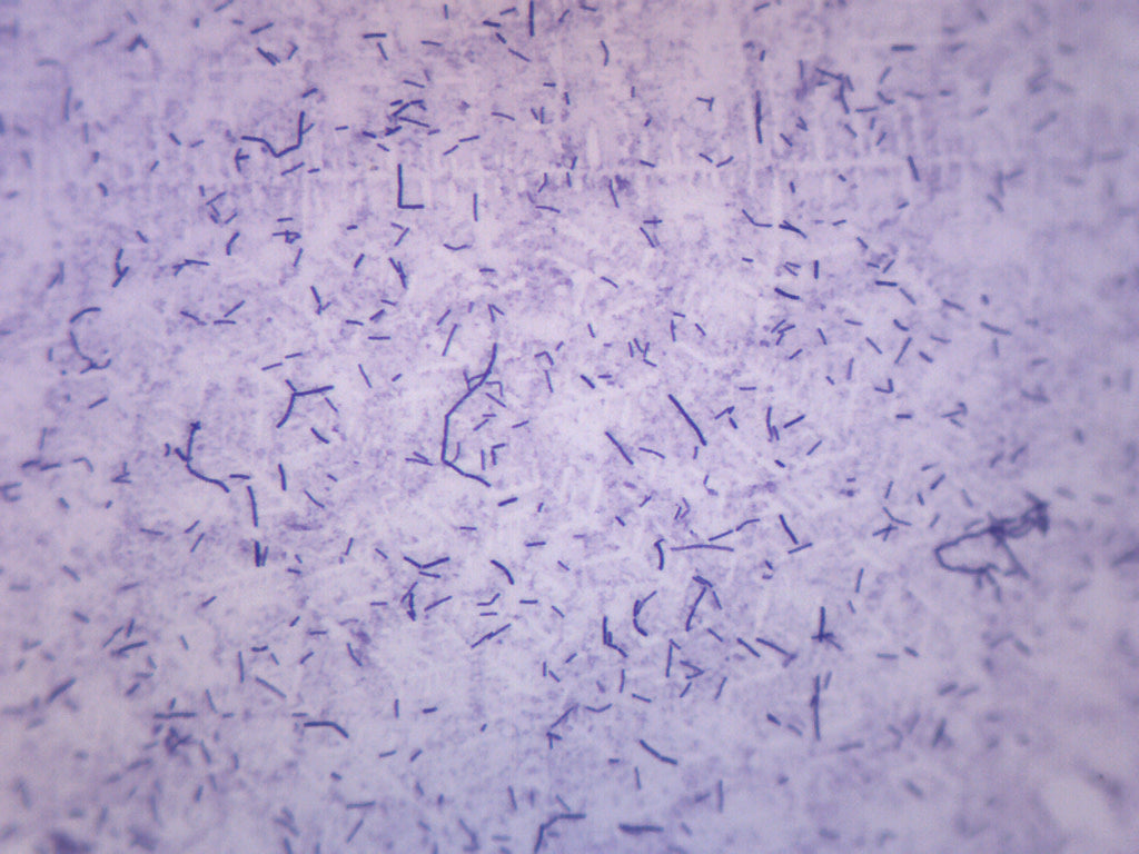 Bacillus Subtilis Negative Stain