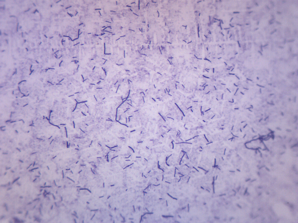 Bacillus Subtilis Gram Stain Positive Or Negative