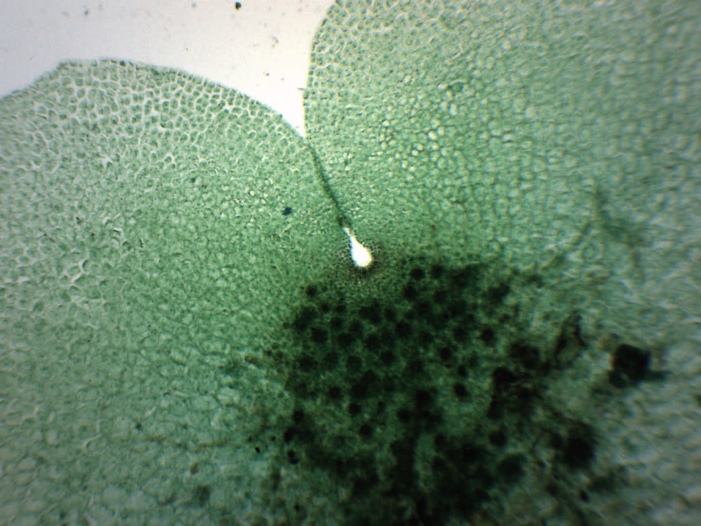 Fern Sporophyte Microscope