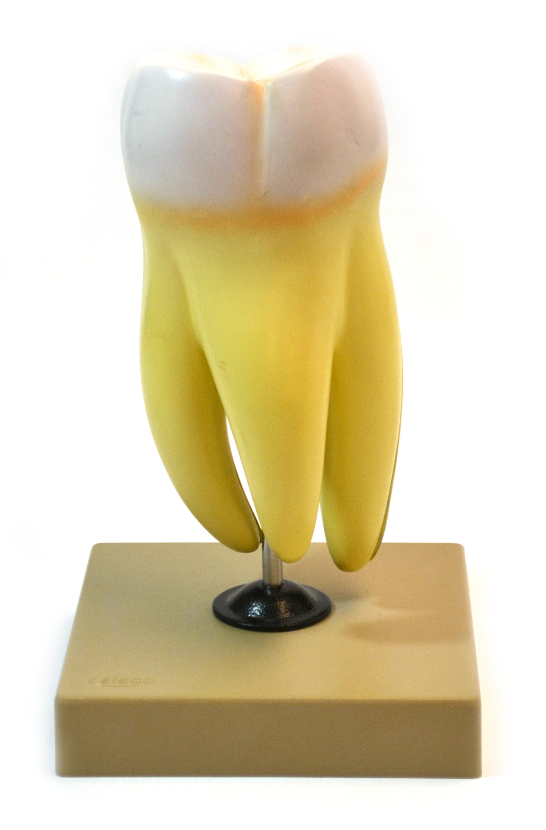 Eisco Labs Human Upper Triple Root Molar with interchangeable cavities