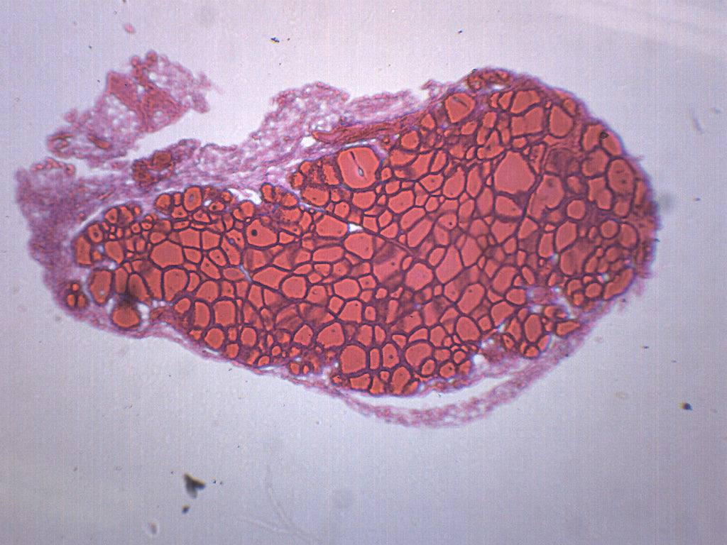 Thyroid Gland Slide Labeled
