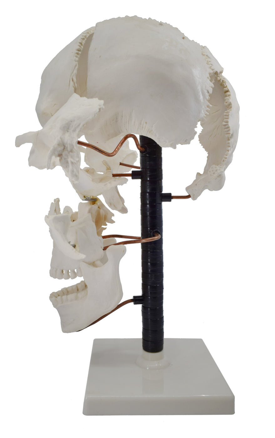Beauchene Exploded Skull Model - 13 Parts - Life Size - Mounted on Sta — Eisco Labs