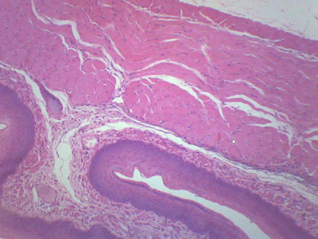 Esophagus And Stomach Slide