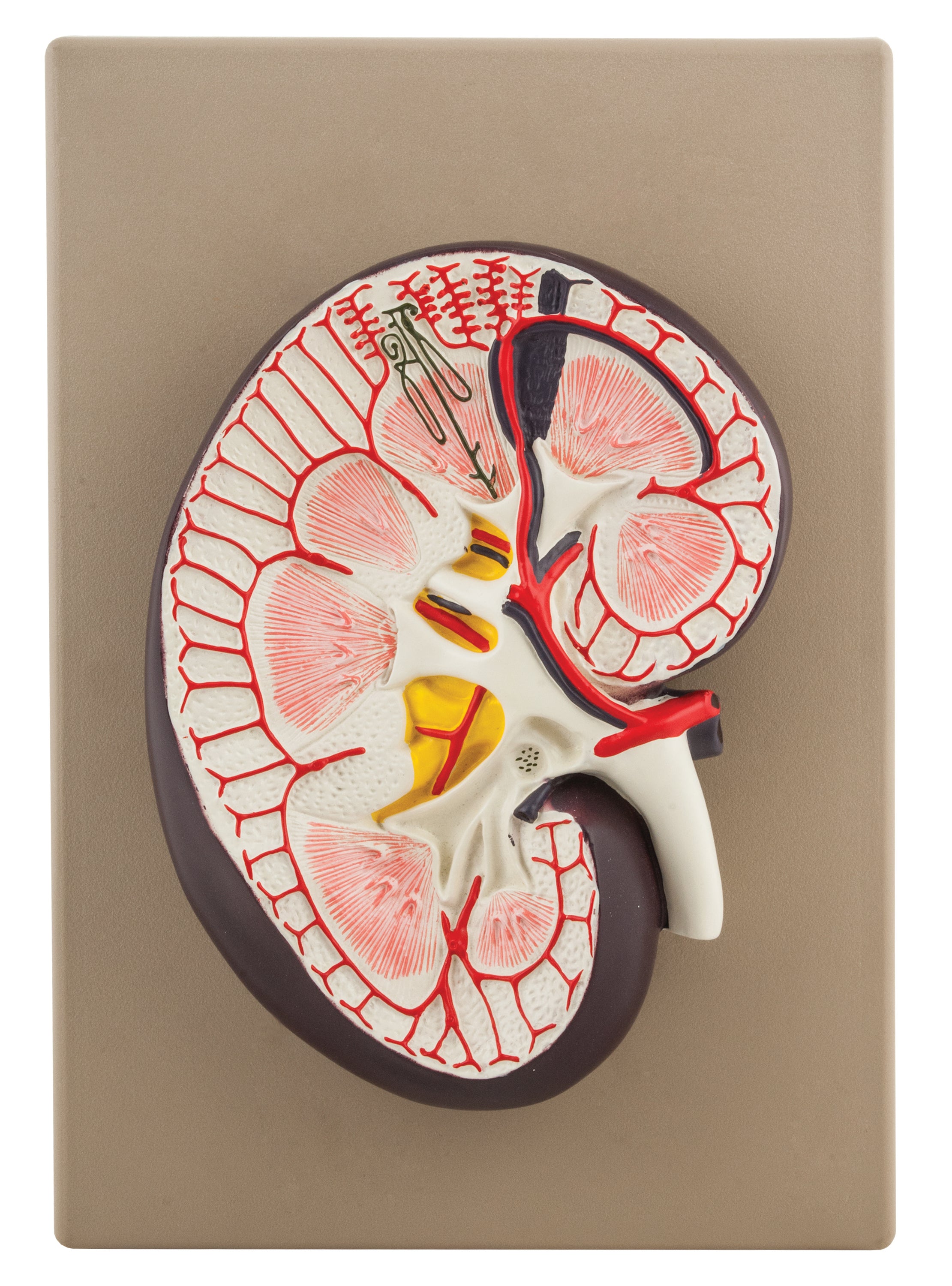 Human Kidney Cross Section Model - 3X Life Size — Eisco Labs
