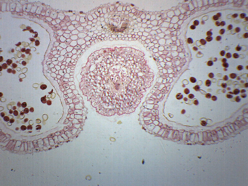 Anther Cross Section