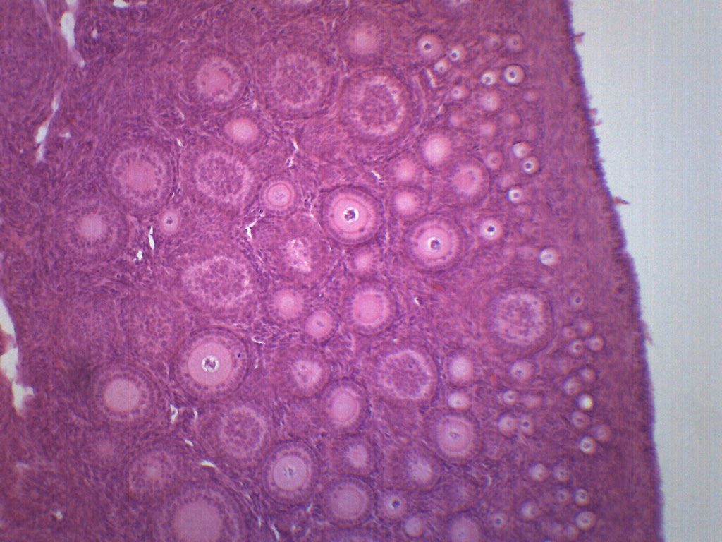 Immature Ovary - Prepared Microscope Slide - 75x25mm — Eisco Labs