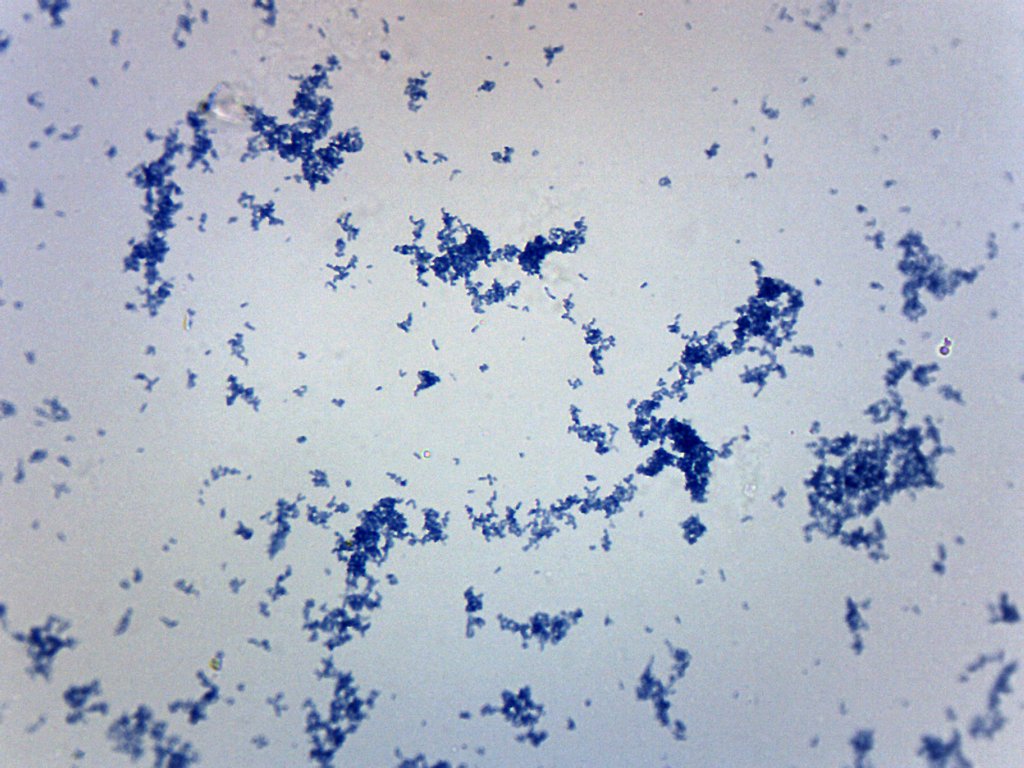 Diphtheria Bacteria Shape