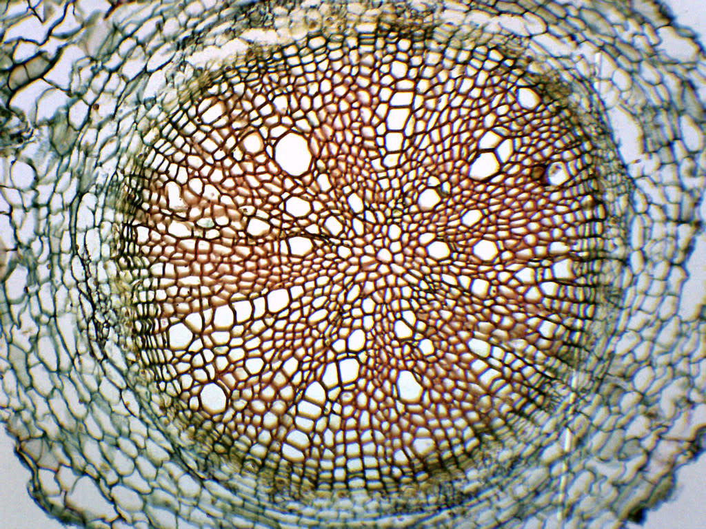 Monocot Stem Under Microscope