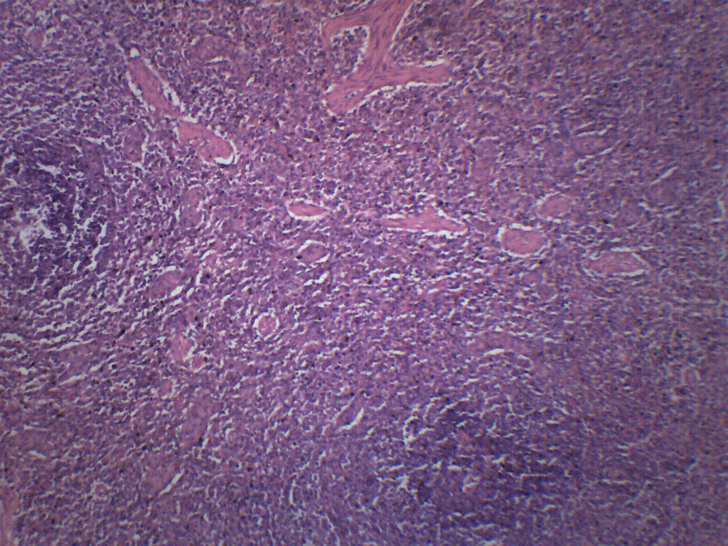 Human Spleen Section - Prepared Microscope Slide - 75x25mm — Eisco Labs