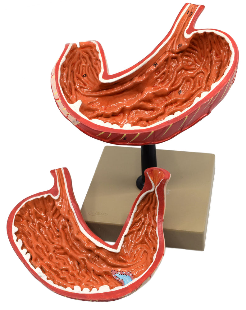 Stomach Model