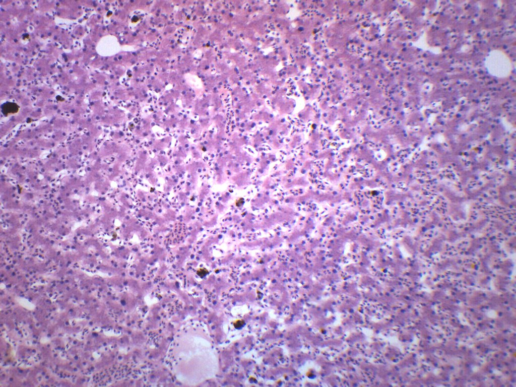 Frog Liver Cells Under Microscope