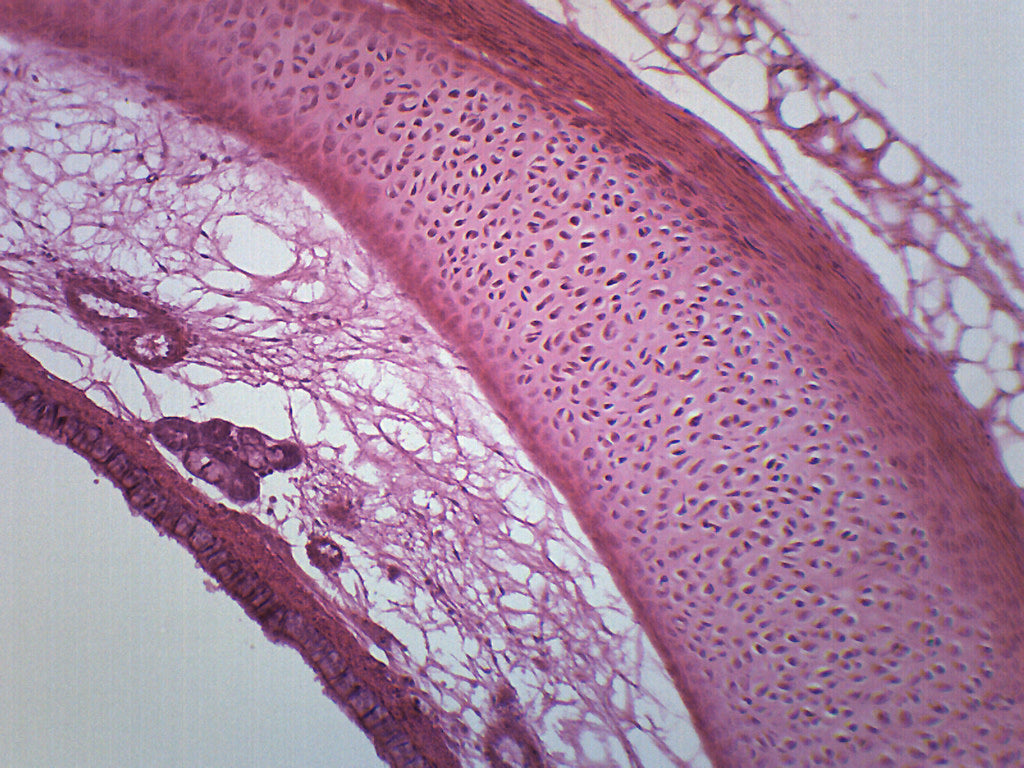 Hyaline Cartilage Under Microscope