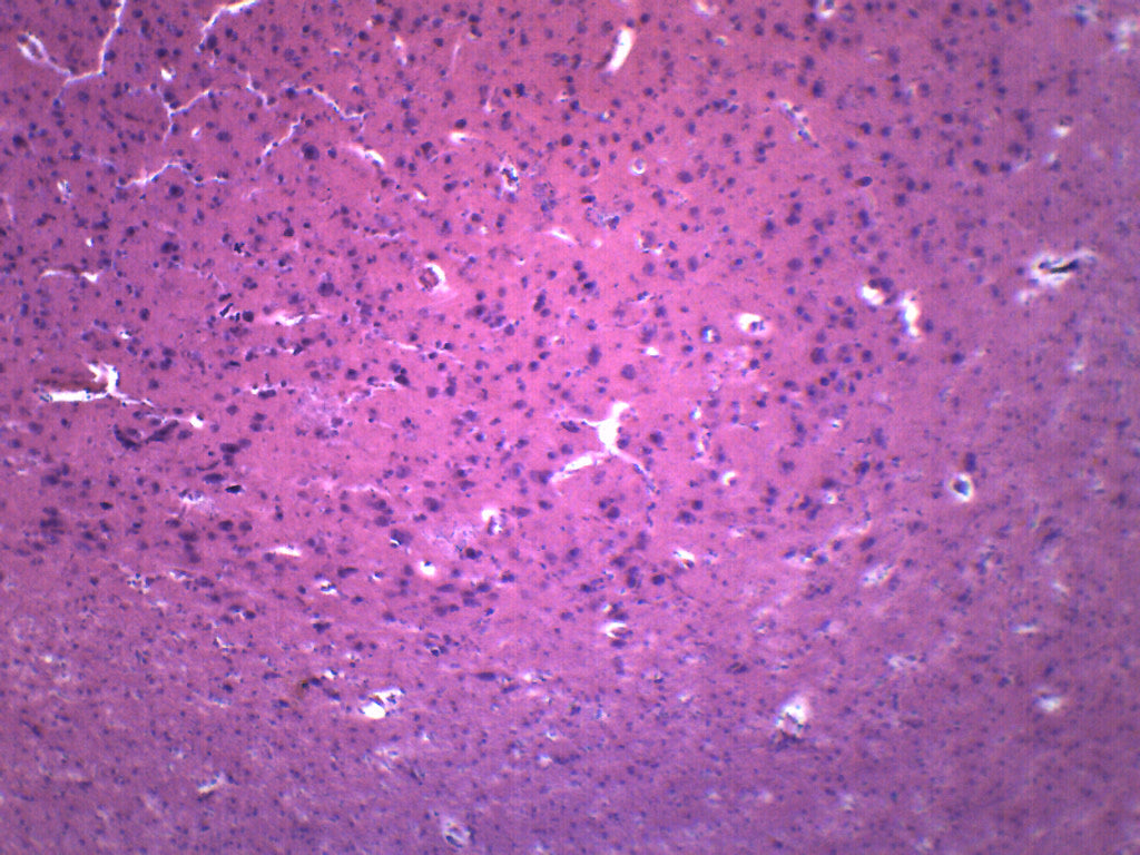 Brain Section - Prepared Microscope Slide - 75x25mm — Eisco Labs