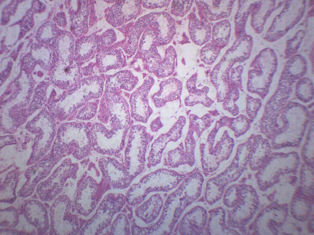 Human Testis Histology