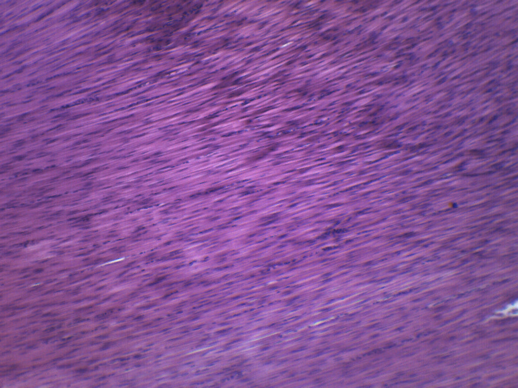 Smooth Muscle, Mammal - Prepared Microscope Slide - 75x25mm — Eisco Labs